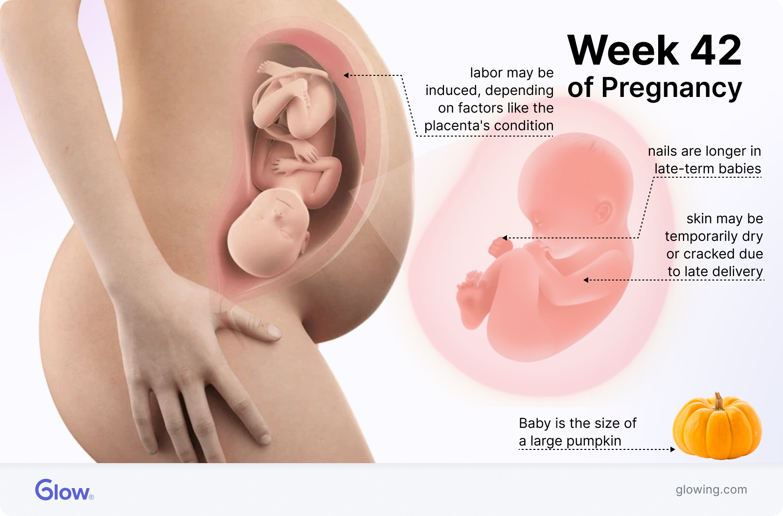 42 Weeks Pregnant: What to Do When You’re Overdue